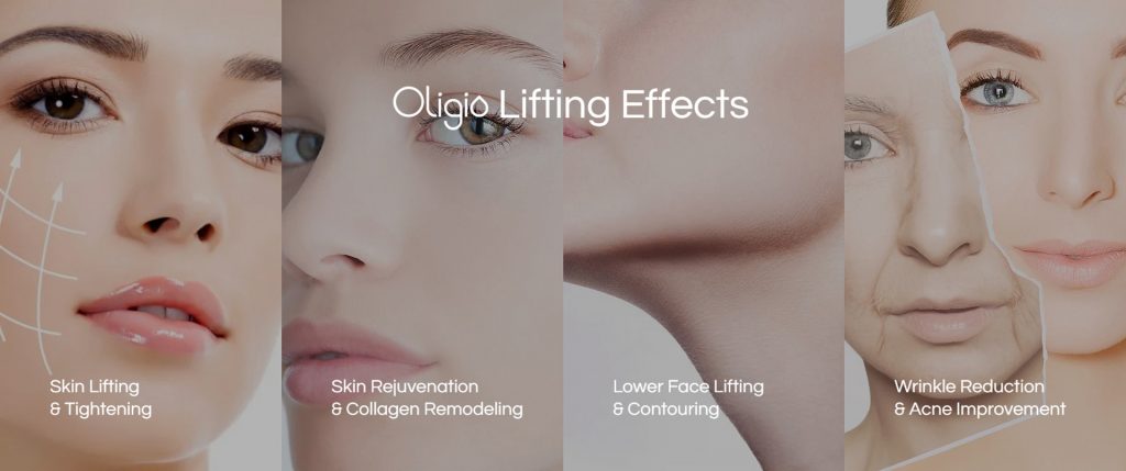Oligio Skin Tightening & Sagging Face Treatment | EE Clinic